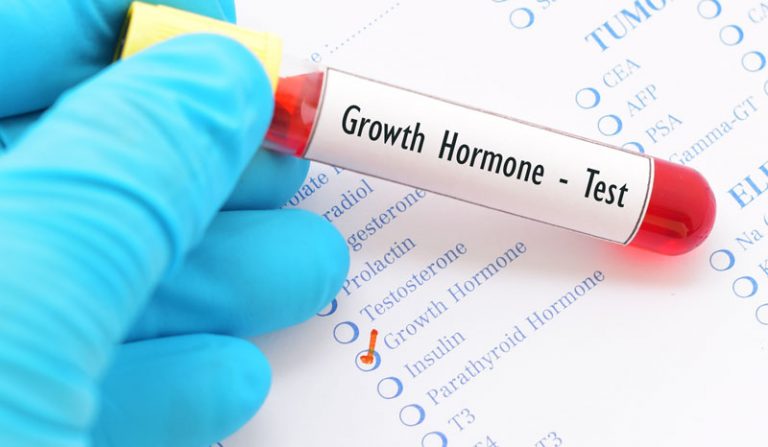 What blood tests are used to determine your growth hormone levels?