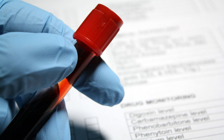 Understanding the blood tests that are used to determine your HGH and ...