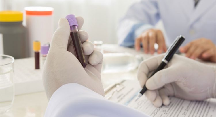 What blood tests are used to determine your growth hormone levels?