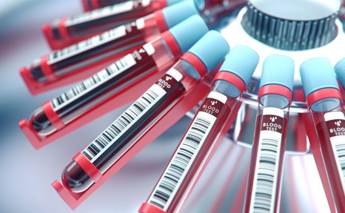 What tests are used to determine your growth hormone and testosterone ...