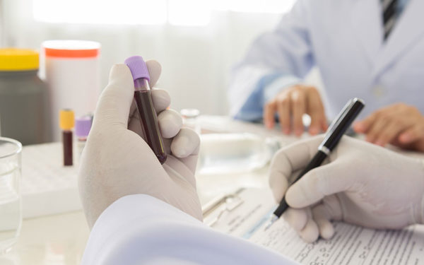 Understanding the blood tests that are used to determine your HGH and ...