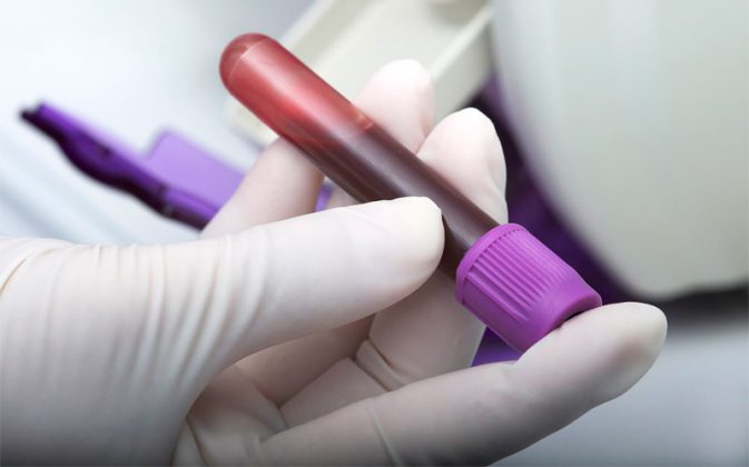 Am I a candidate for Testosterone Replacement Therapy?