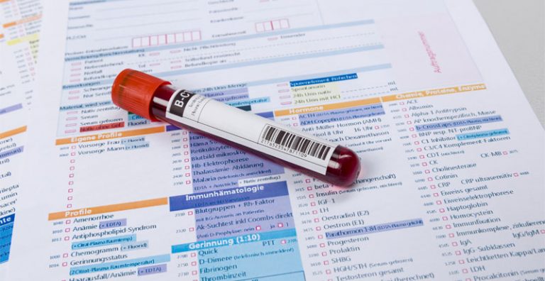 What tests are used to determine your growth hormone and testosterone ...