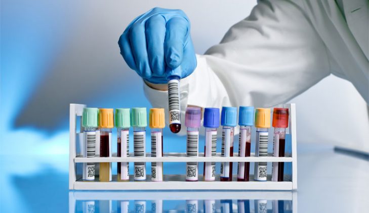 What Can We Learn From Testosterone Blood Tests