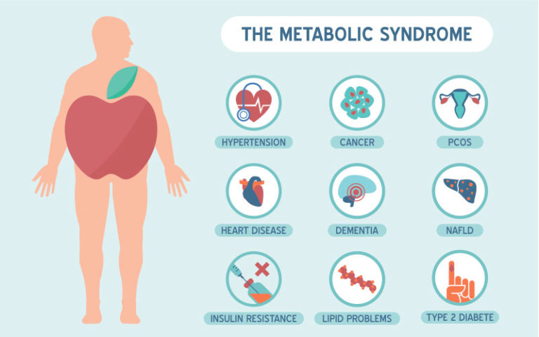 The Link Between Low Testosterone and Metabolic Syndrome