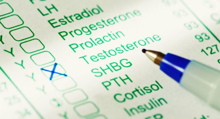 What blood tests are used to determine your testosterone levels?